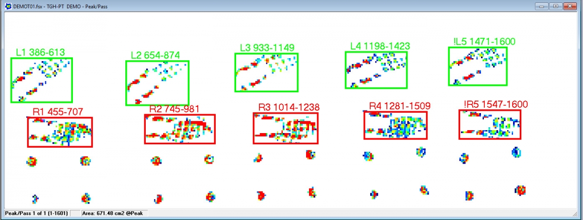 Gait Analysis System | Strideway System | Tekscan